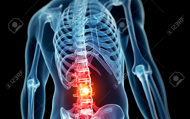 Dolor en la columna Fisioterapia Especializada Francisco Lledó