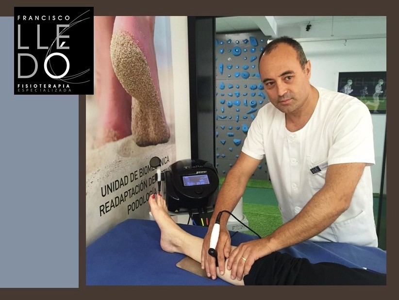 tecarterapia diatermia en fisioterapia