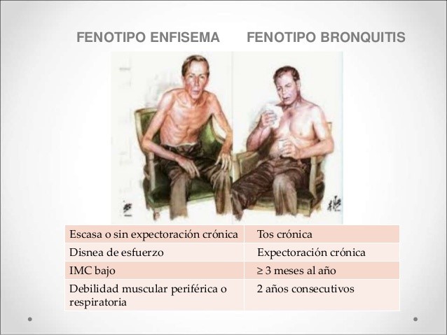 La Enfermedad Pulmonar Obstructiva Crónica - EPOC Fisioterapia ...